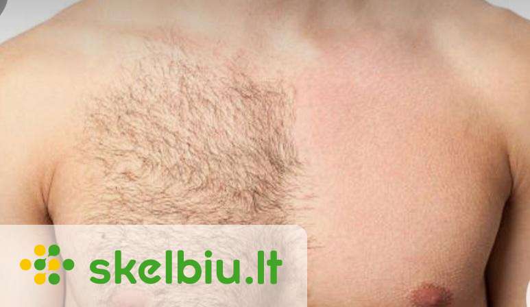 Depiliacija Vyrams Akcija pilnas bikinis tik 40€ - Skelbiu.lt